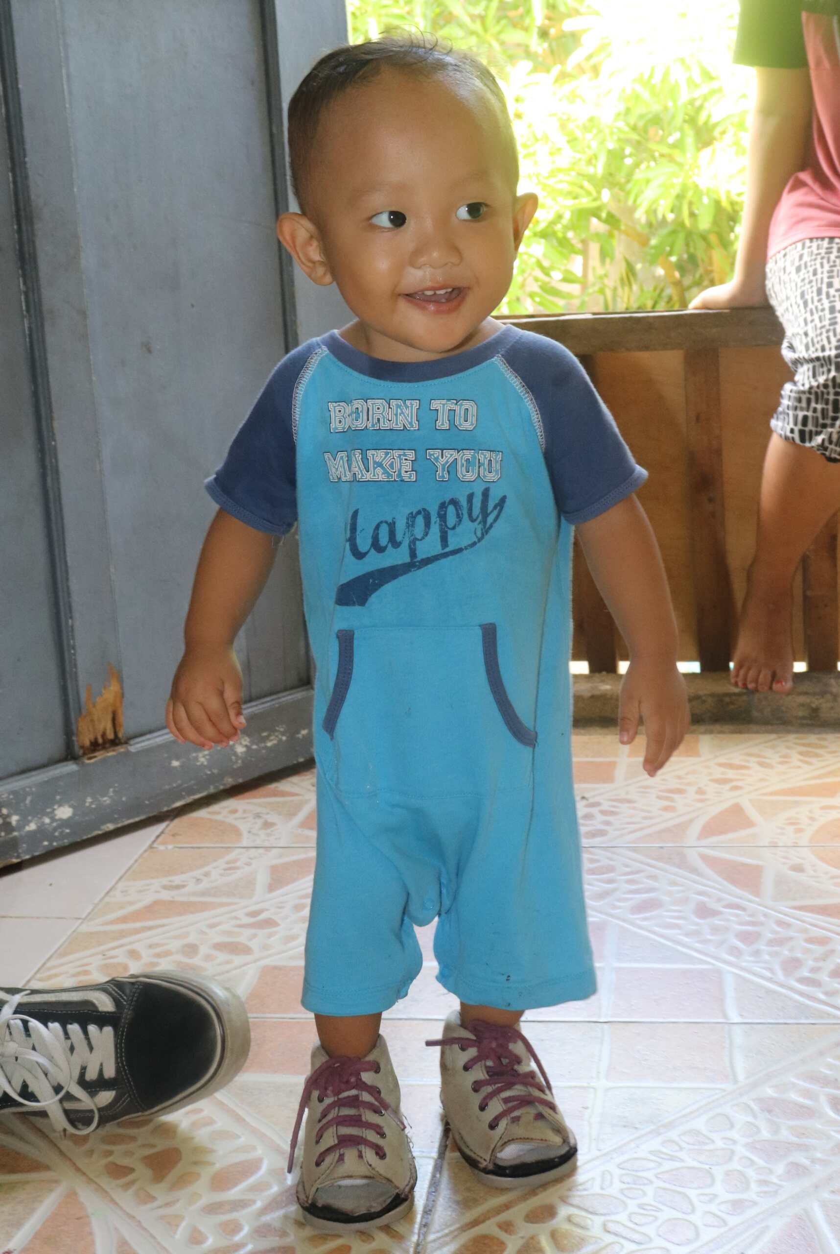 Footprints of Triumph Chadd’s Clubfoot Journey | CBM Australia